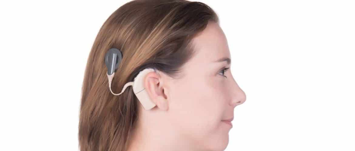 Más de 300 murcianos recuperan la audición gracias al implante coclear ...